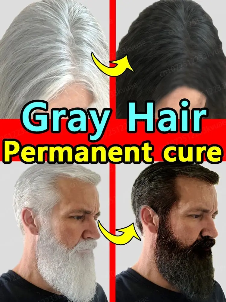 White-hair-treatment-essence-quickly-turns-white-hair-into-black-hair ...