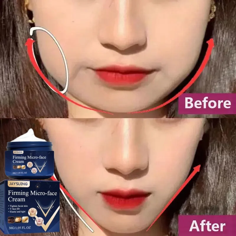 Effective-Face-V-Shape-Lift-Slim-Cream-Remove-Double-Chin-Create ...