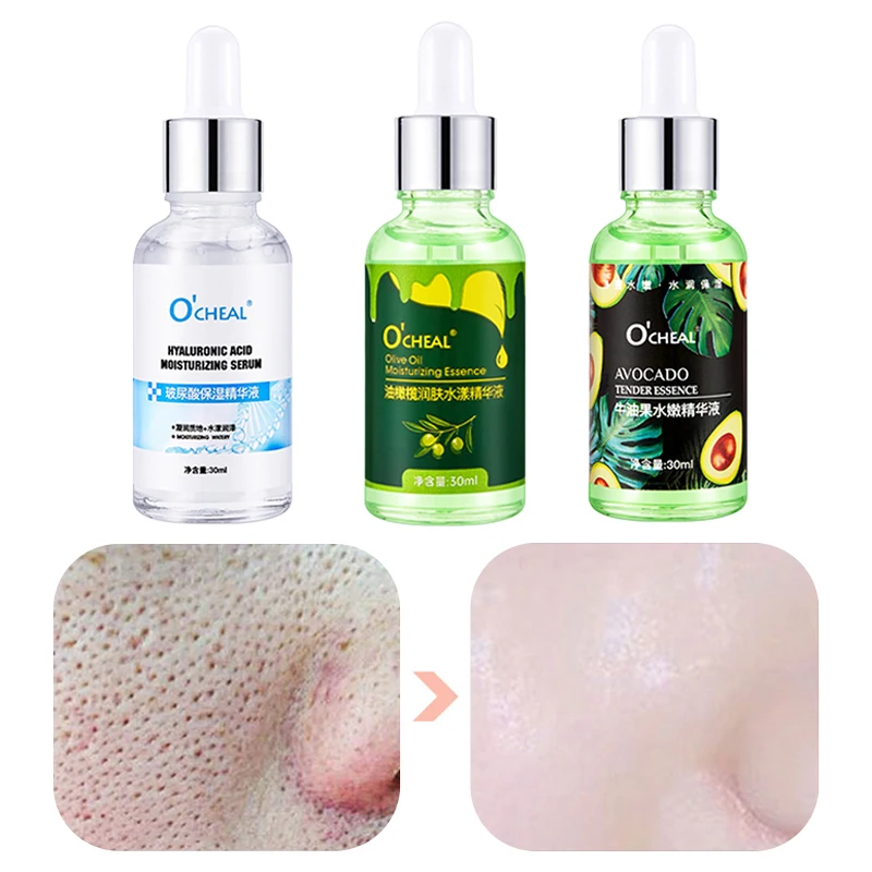 OCHEAL Face Serum Moisturizing Anti-aging Wrinkle Hyaluronic Acid ...