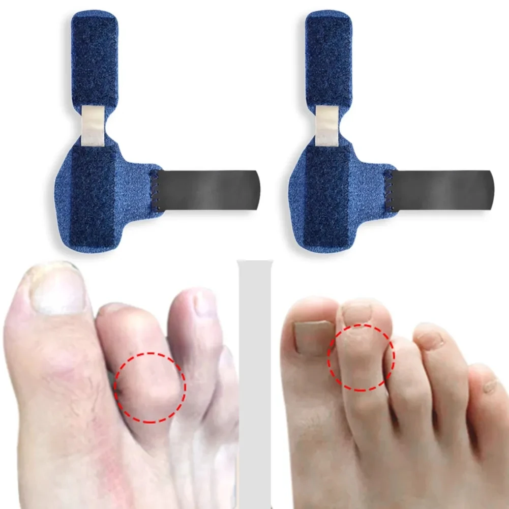 Toe-Splint-Straightener-martelo-separador-dedos-tortos-garra ...