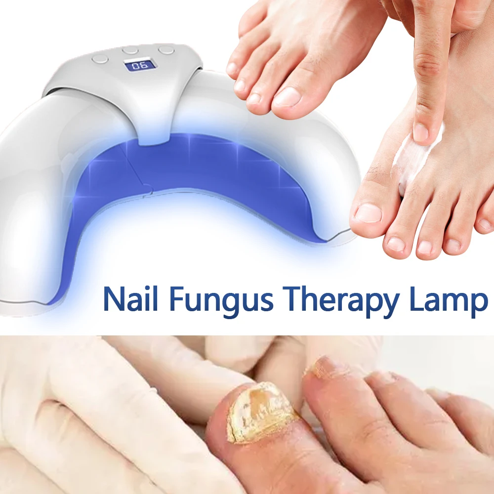 Nail-Fungal-Laser-Device-Repair-Fast-Nails-Fungus-Onychomycosis-Repair ...