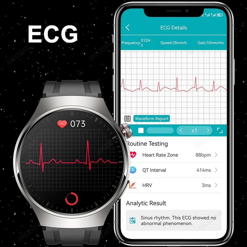 Reloj inteligente para hombre, pulsera con control del ritmo cardíaco, ECG + PPG, Bluetooth ...