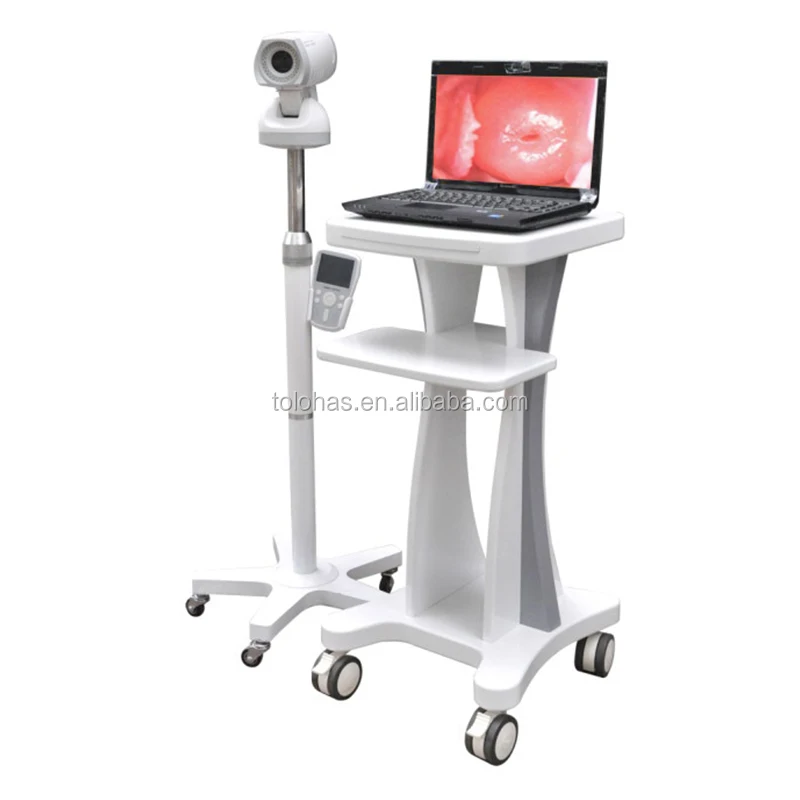LH9800A-Digital-Video-Gynecological-Colposcopy-Endoscopes-Wheeled ...