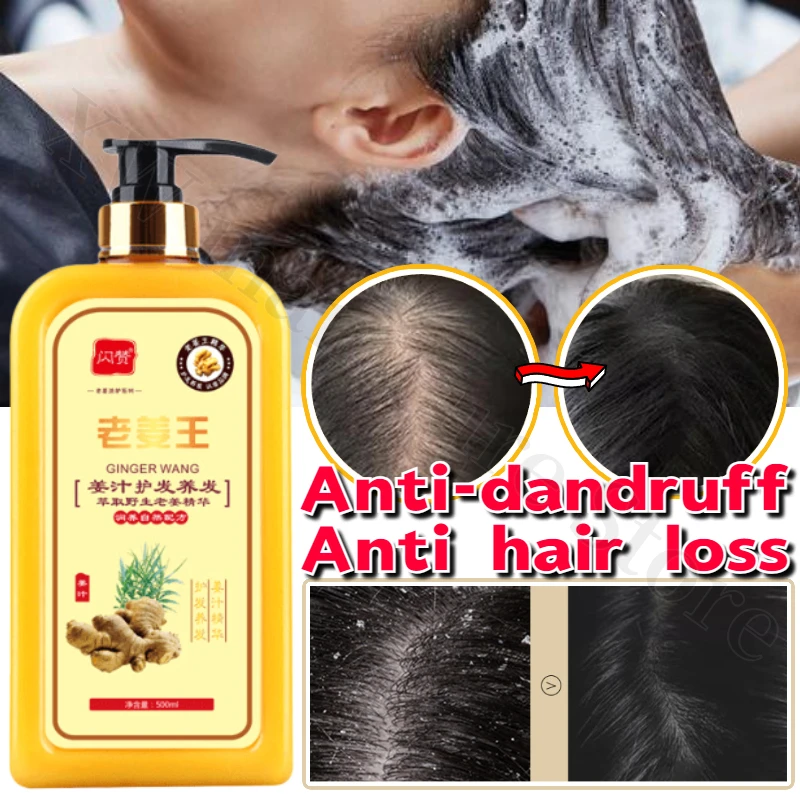 Ginger Anti-hair Loss Shampoo Professionally Repairs Damaged Hair ...