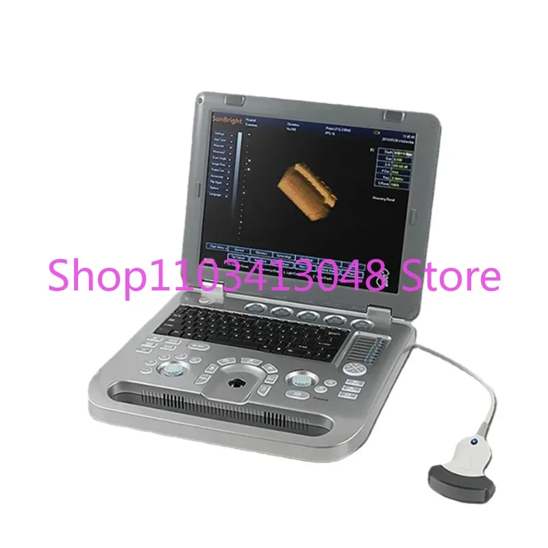 3D-Portable-Ultrasonic-Baby-Scanner-Ultrasound-Echo-Ultrasonography ...