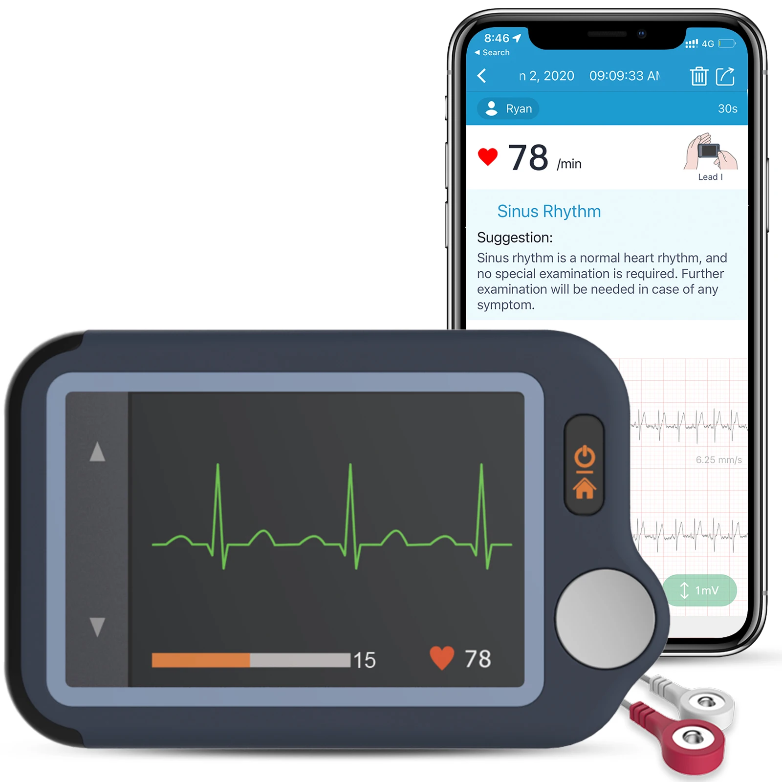 Multifunktions-Touch-Panel-EKG-EKG-Herz-Monitor-f-r-Herzrhythmusst ...