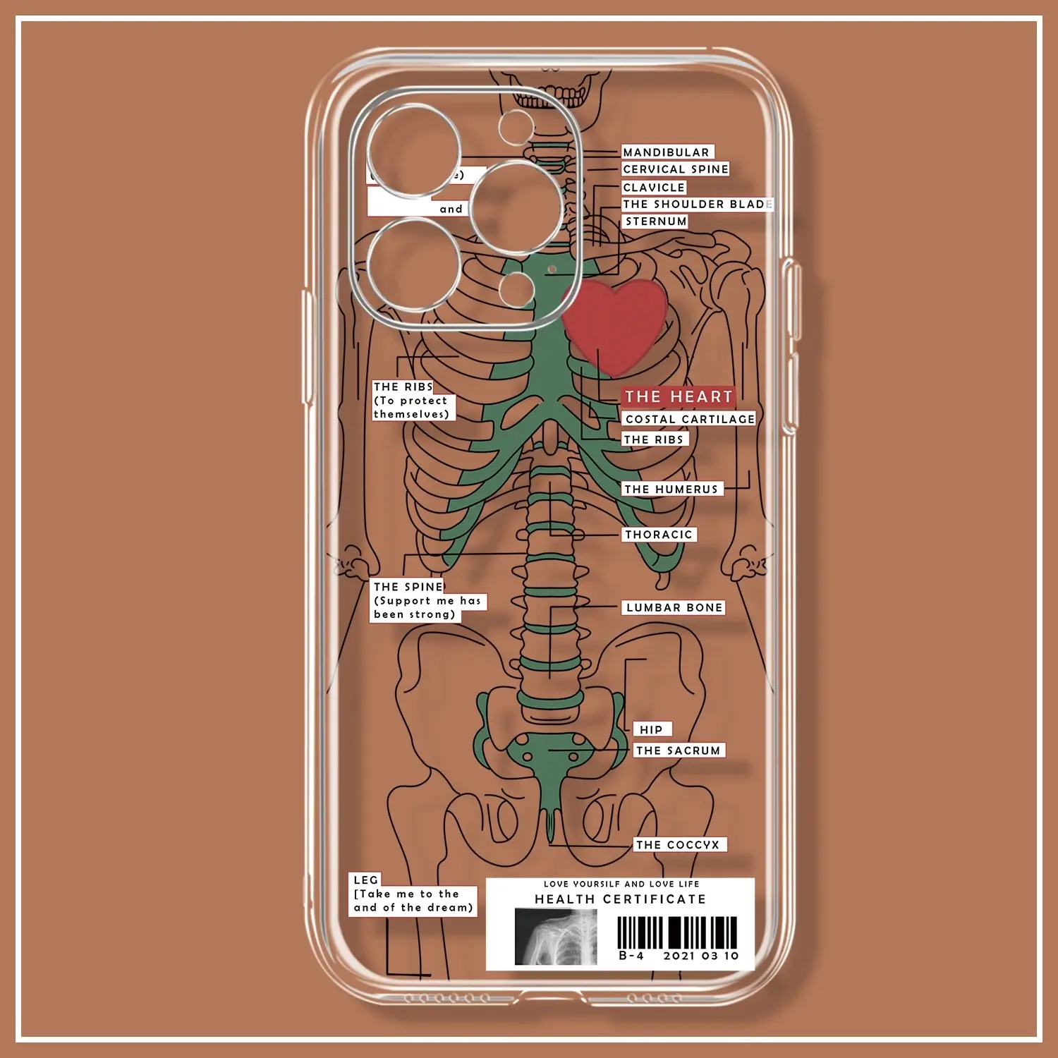 Medical-Student-Bone-Phone-Case-iPhone15-14-13-11-12-Pro-Max-Mini-X-XR ...