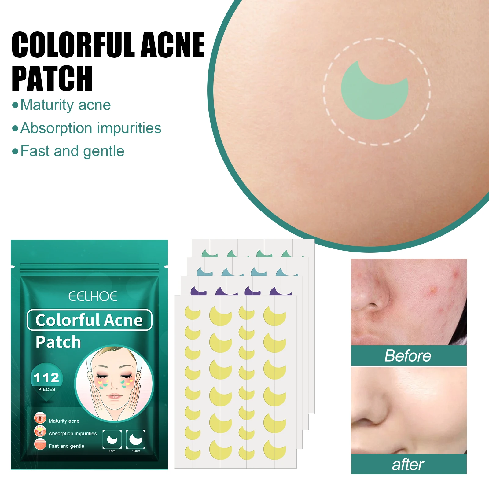 Moon-Shape-Acne-Zit-Patches-Colorful-Hydrocolloid-Pimple-Healing ...