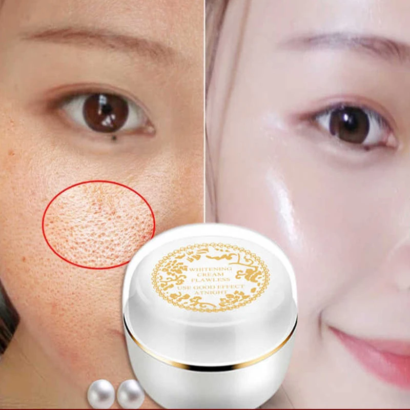 Lady-Face-Whitening-Cream-For-Dark-Skin-Spots-Scars-Snow-White-Cream ...