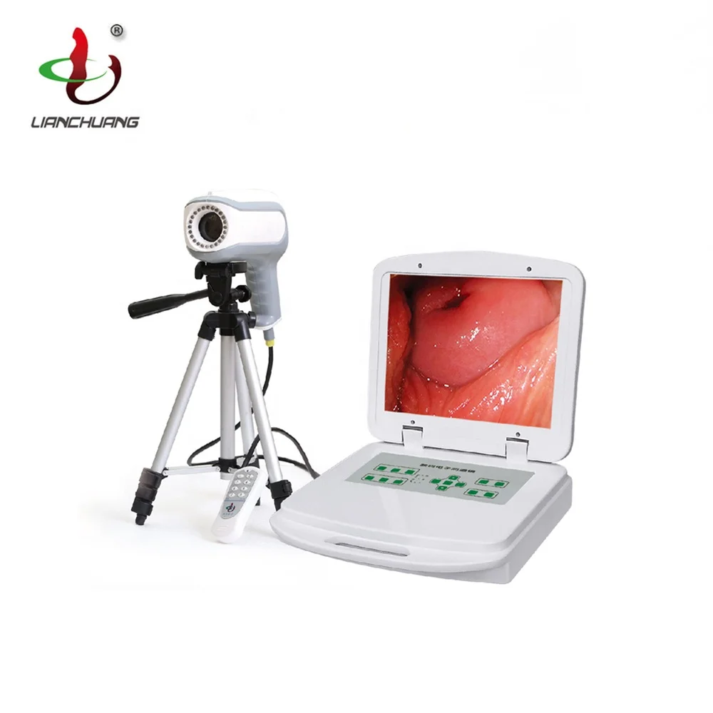 V-deo-digital-port-til-Colposc-pio-eletr-nico-c-mera-para-Gyology-CCD ...