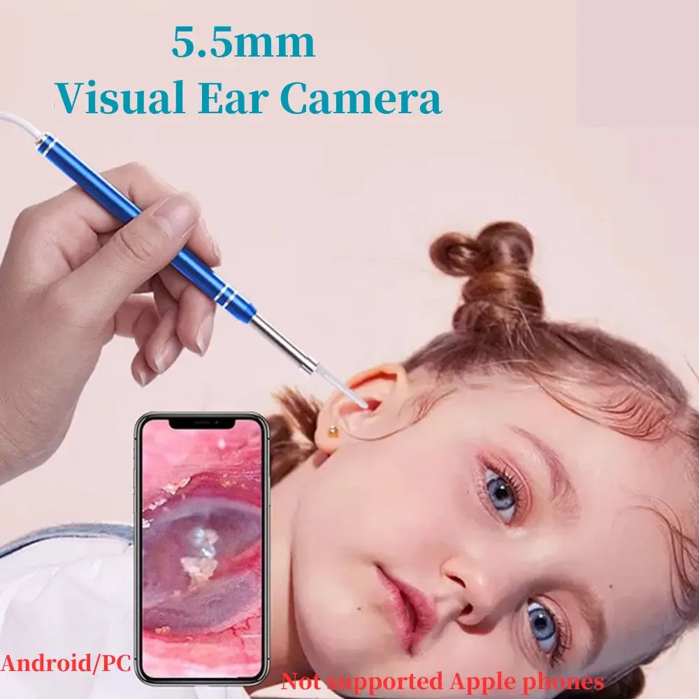 HD Visual Ear Endoscope 3 in 1 USB Otoscope for Android and PC: A ...