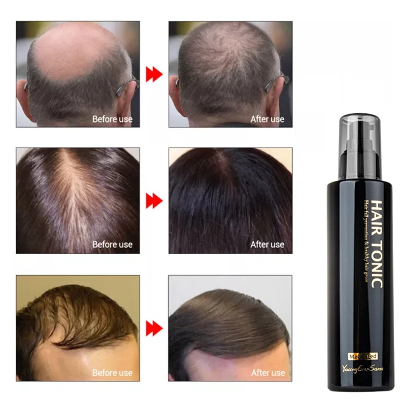 YoungEverSama-Hair-Rich-Serum-Hair-Enhance-Agent-Anti-hair-Loss-Hair ...