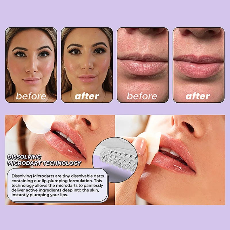 1 Pair Hyaluronic Acid Microneedle Lip Patches For Anti Wrinkle ...