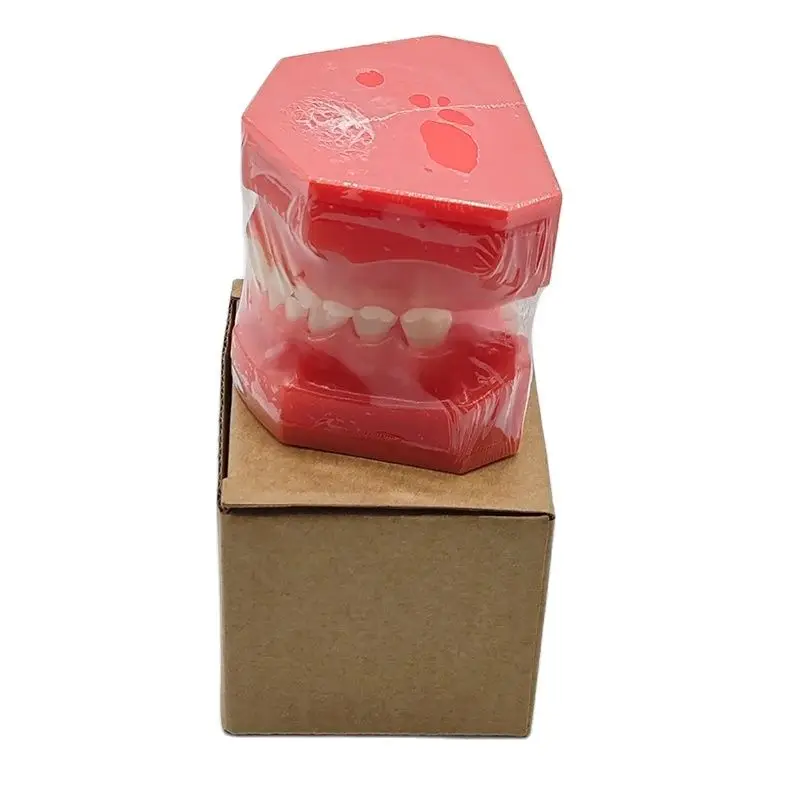 Dental-M7013-Pediatric-development-Model-age-9-12-Dental-Teeth-Model ...