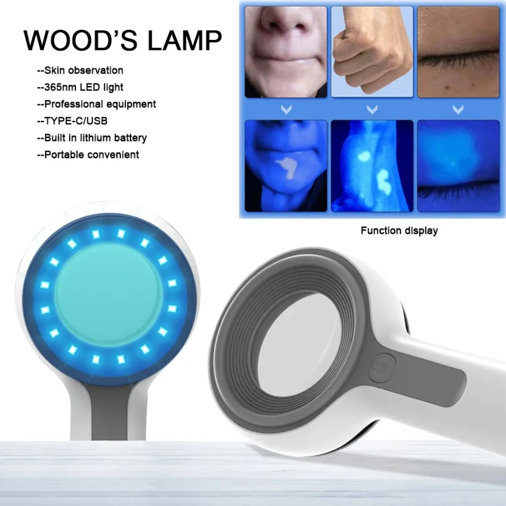 FODRK-Woods-Lamp-UVA-Lamp-For-Vitiligo-Detection-Dermatoscope-Skin ...