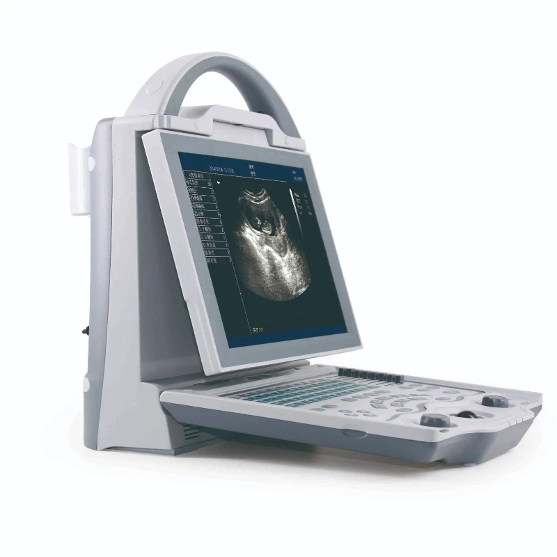 Portable-Human-Ultrasound-Scanner-Ultrasonic-Diagnostic-Instruments.jpg