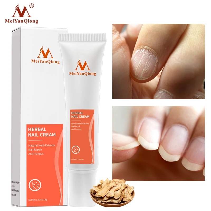 Nail-Repair-Cream-Prevent-Paronychia-Prevent-Fungal-Infection-Manicure ...