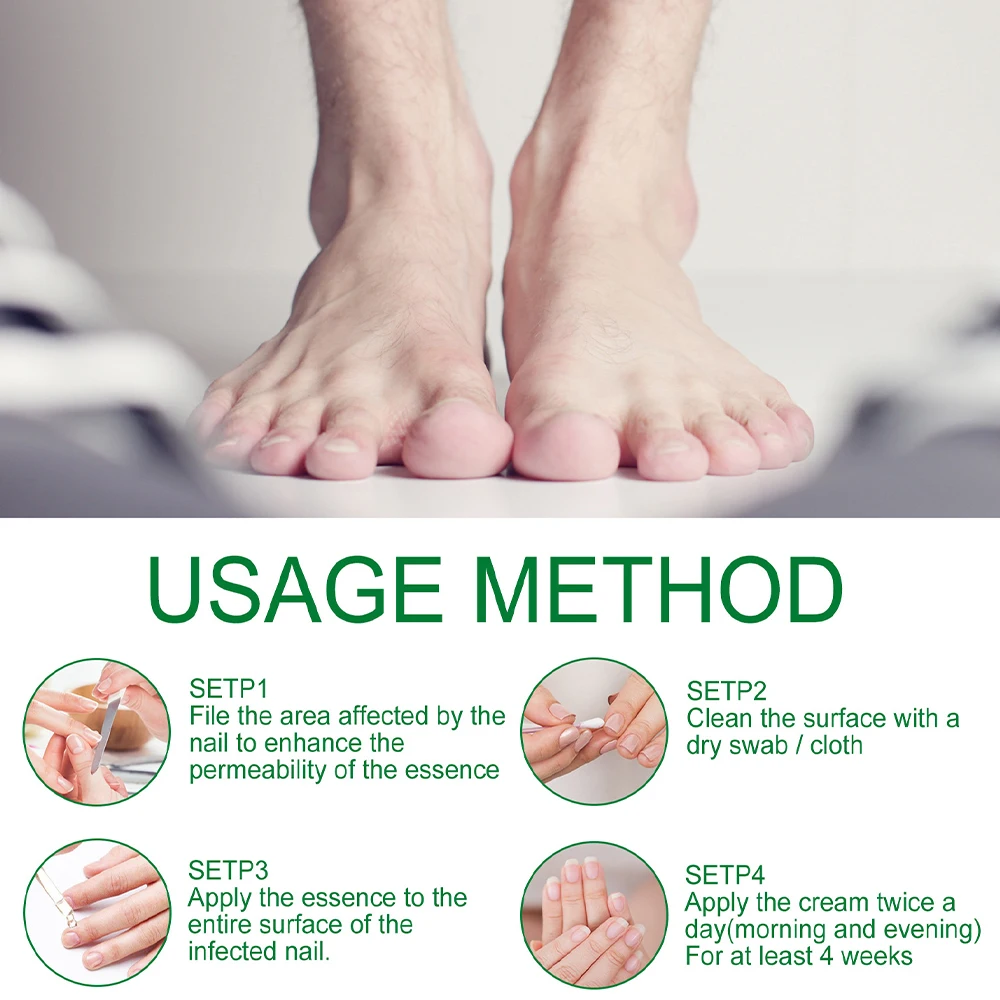 30ml Repair Nail Fungus Treatments Essence Foot Care Serum Toe Nails ...