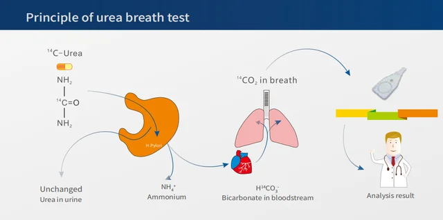 Urease Breath Test