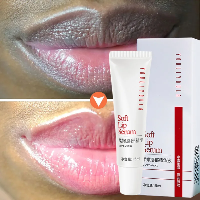 Lips-Pink-Fresh-Lightening-Bleaching-Cream-Treatment-Remove-Dark-Smoke ...