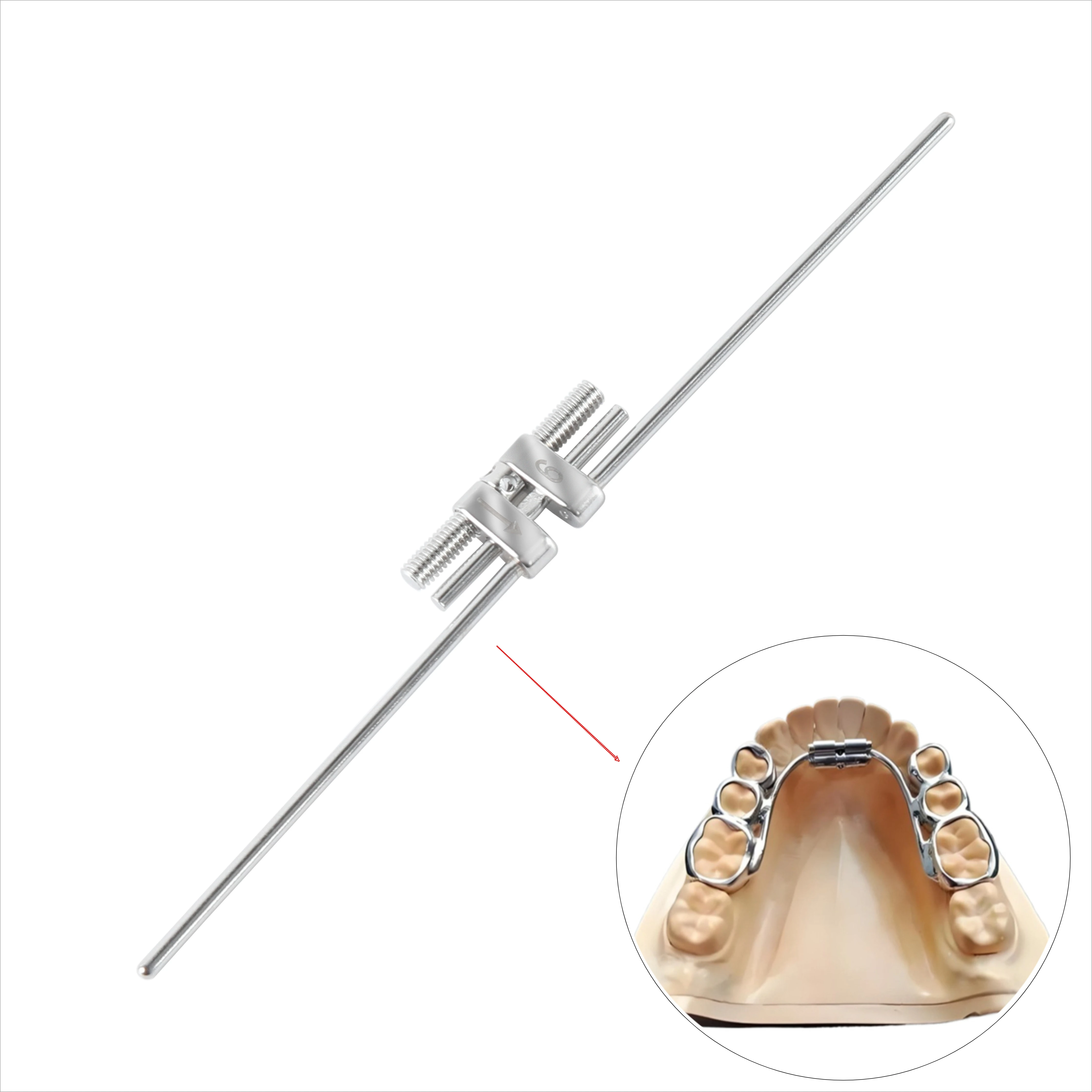 10 Uds tornillo de expansión de ortodoncia ajustable mandíbula inferior ...