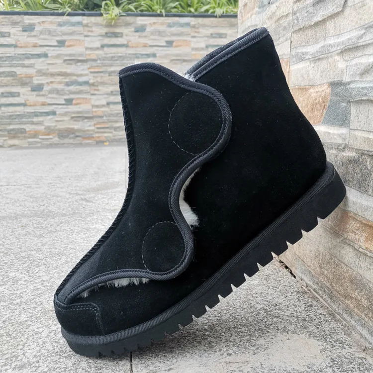 Fat Ankle Shoes