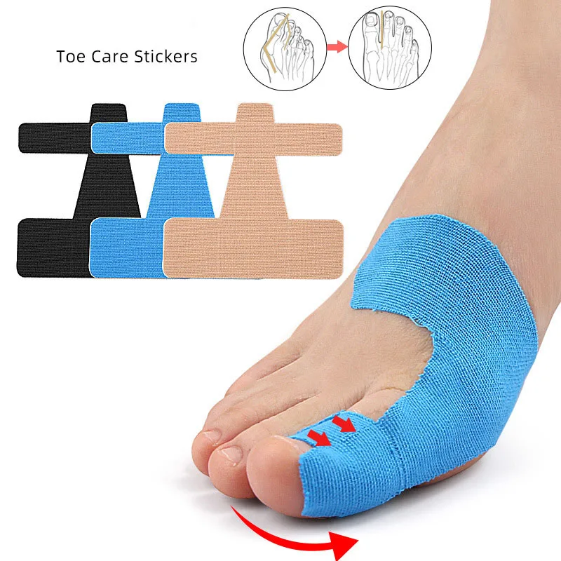 10Pcs Bunion Corrector Orthopedic Bunion Strap Breathable Toe Separator ...