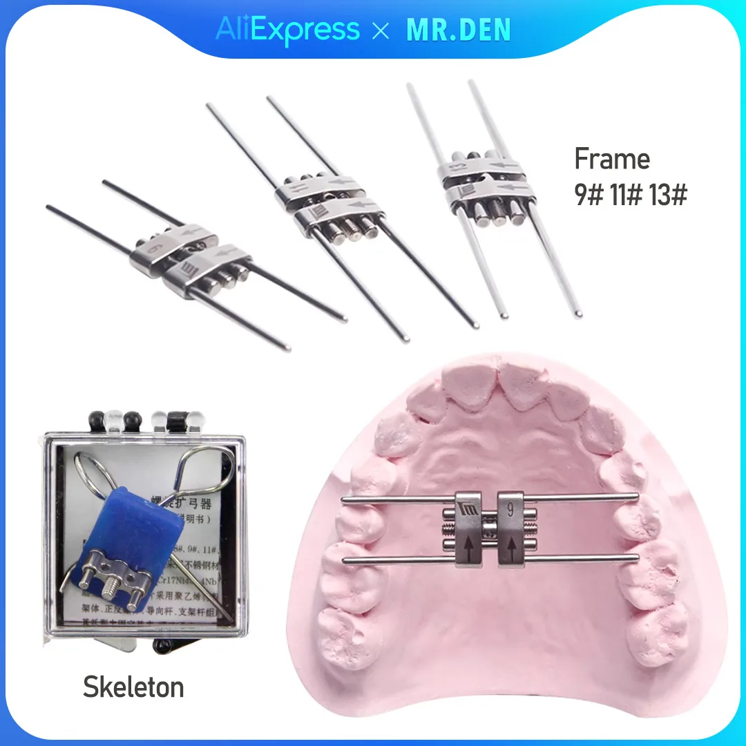 High-Quality-Dental-Orthodontic-Spiral-Expander-Screws-Stainless-Steel ...