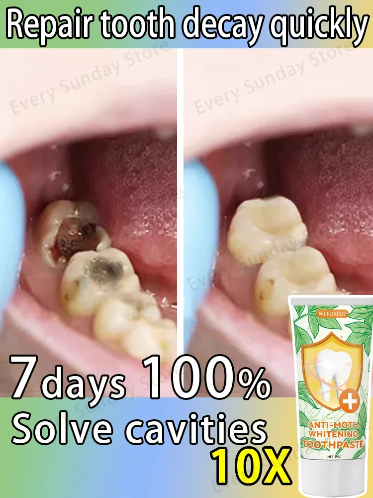 Best-selling-scientific-fluoride-repairs-cavities-removes-cavities ...