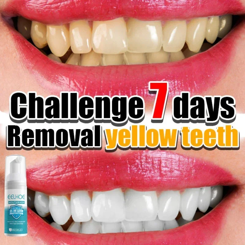 Push-type-Mousse-Toothpaste-Whitens-Teeth-Cleans-Mouth-Tartar-Tooth ...