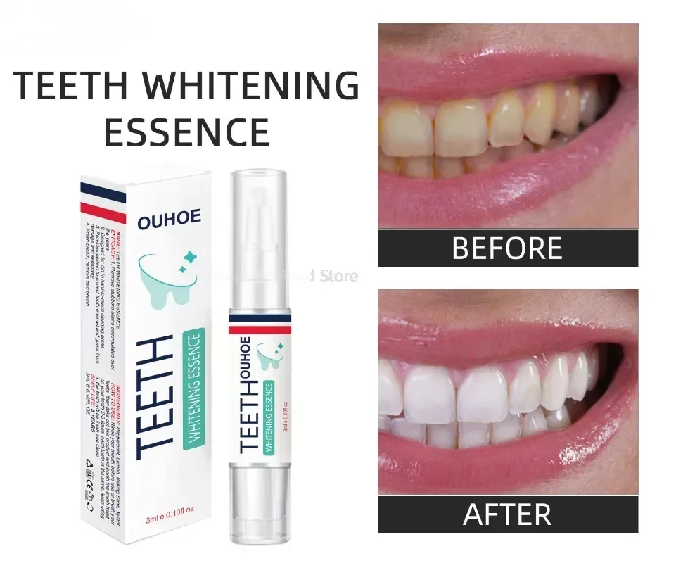 Teeth-Whitening-Pen-Tooth-Gel-Whitener-Bleach-Remove-Stains-Instant ...