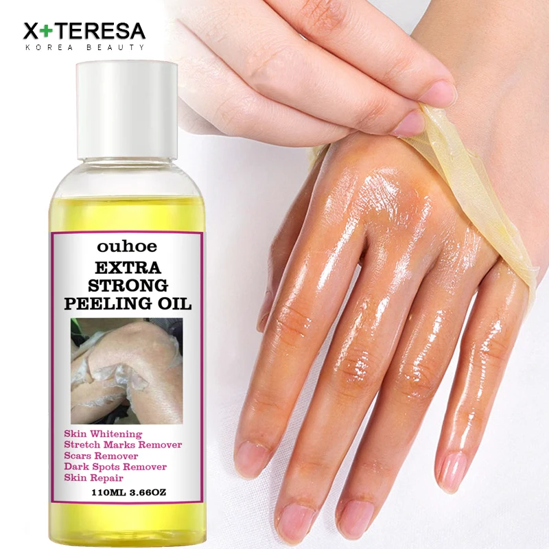 Yellow-Peeling-Oil-Bleaching-Dark-Skin-Lighten-Elbows-Knees-Hands ...