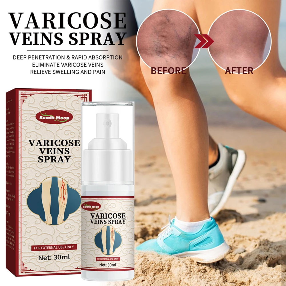 Spray-de-masaje-para-venas-varicosas-mejora-la-circulaci-n-sangu-nea ...