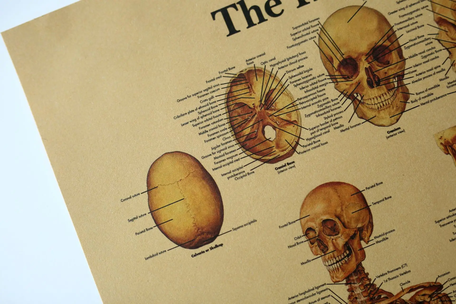 Petrosquamous Suture