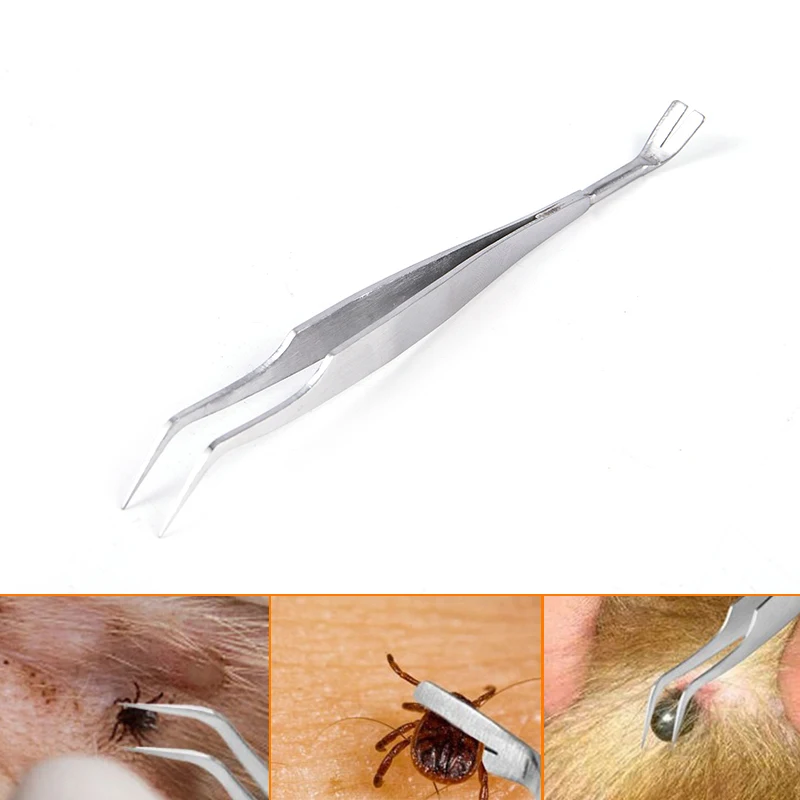 2-In-1-Professional-Tick-Removal-Tool-Stainless-Steel-Tick-Tweezers-for ...