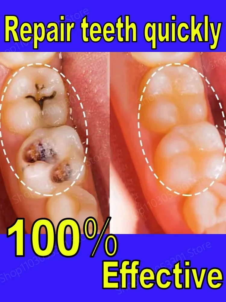 Fluoride-toothpaste-prevents-tooth-decay-freshens-breath-whitens-and ...