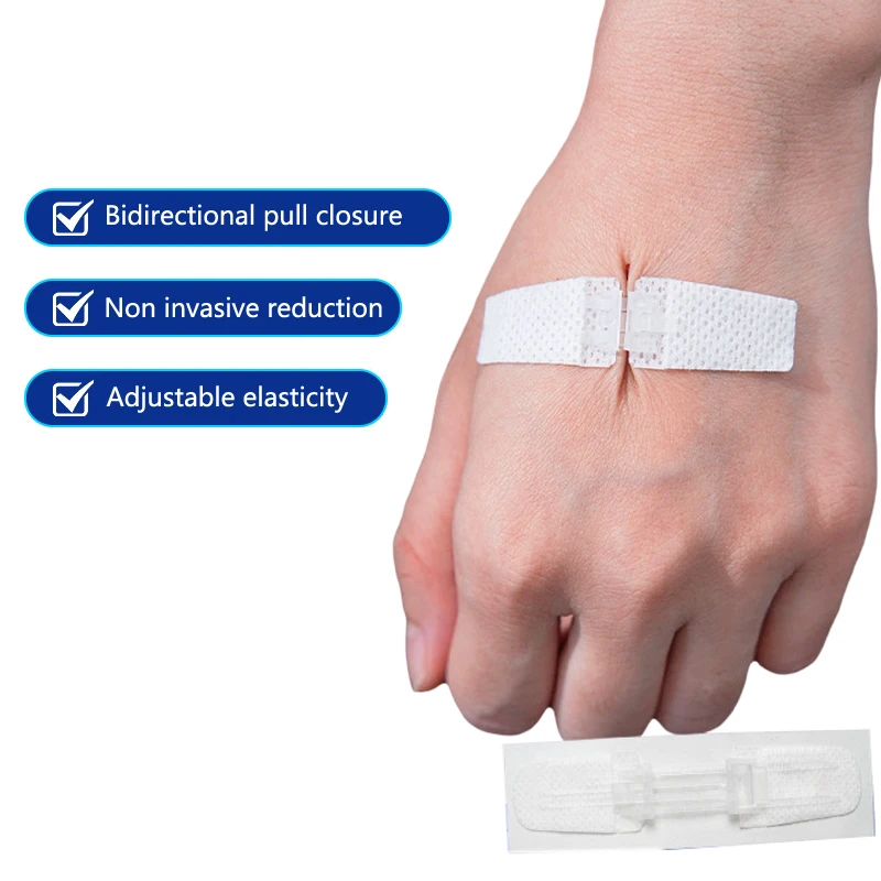 Zipper Painless Wound Closure Device Suture-free Wound Dressing Closure ...