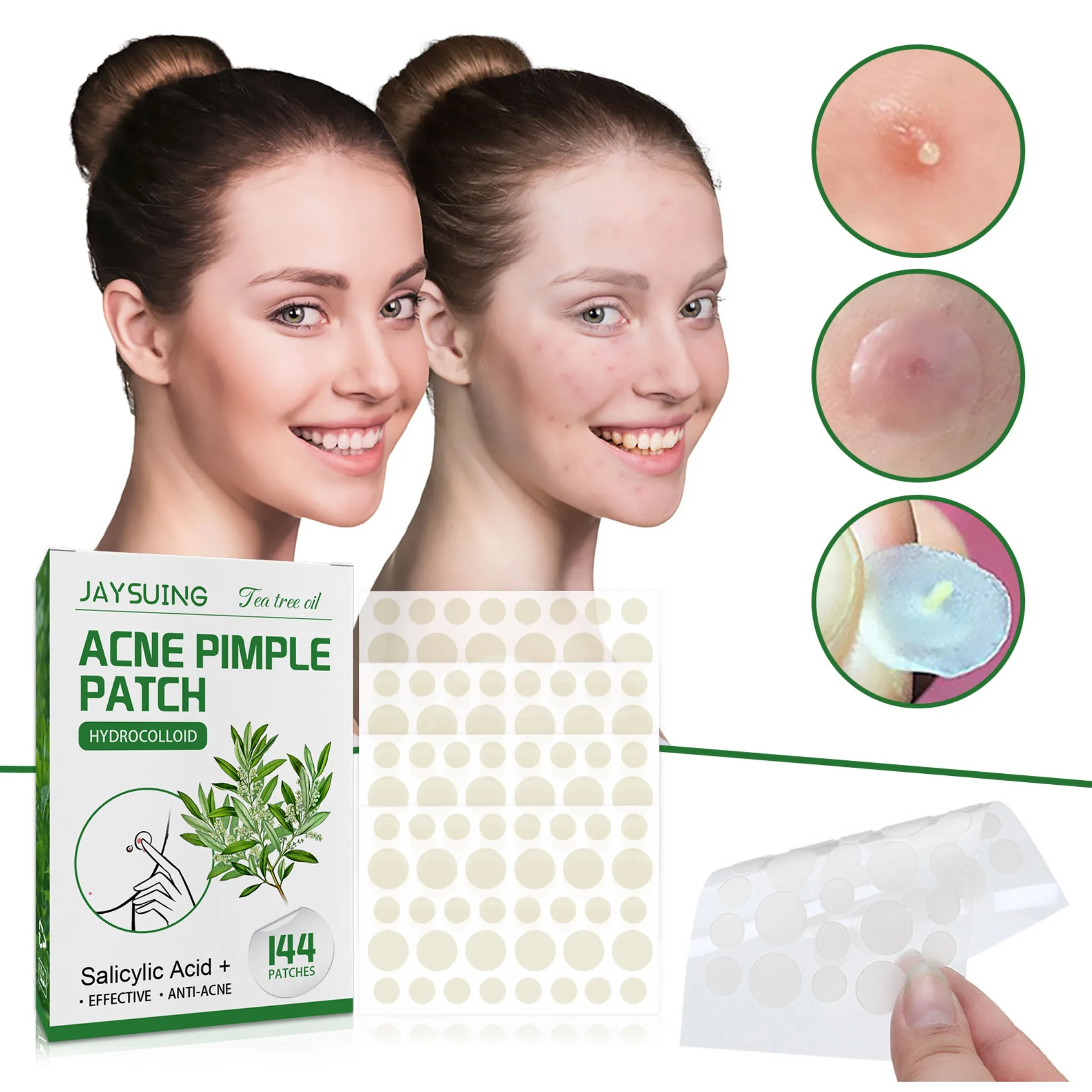 144-Pcs-Acne-Pimple-Patch-Invisible-Breathable-Acne-Pimple-Stickers ...