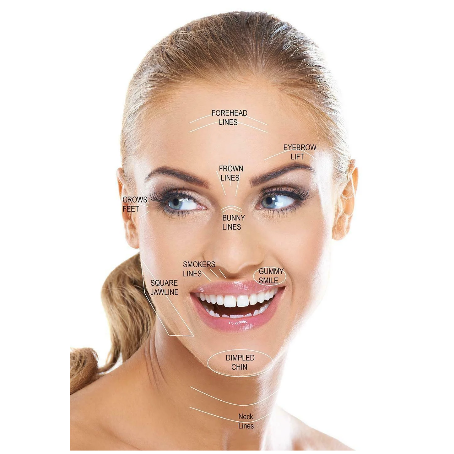 Aesthetics-Botox-Treatment-Areas-Advertising-Facial-Posters-Canvas-Wall ...