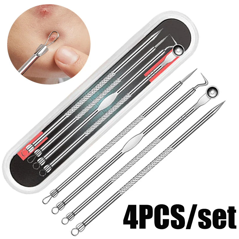4pcs-set-Acne-Removal-Needles-Stainless-Steel-Pimple-Blemish-Blackhead ...