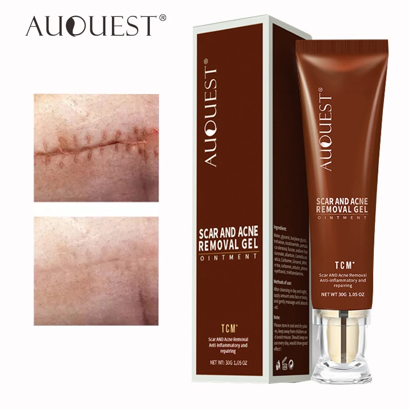 AUQUEST Scar Repair Cream Stretch Marks Acne Remove Promote Cell ...