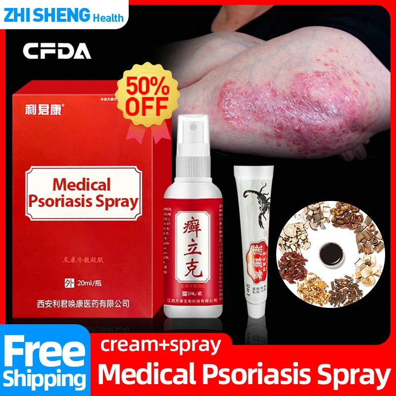 Psoriasis-Treatment-Herbal-Spary-Dermatitis-Skin-Problems-Relief-Hand ...