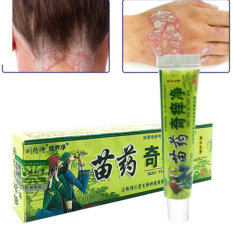 15g-Skin-Psoriasis-Ointment-Eczema-Antipruritus-Cream-Moist-and ...