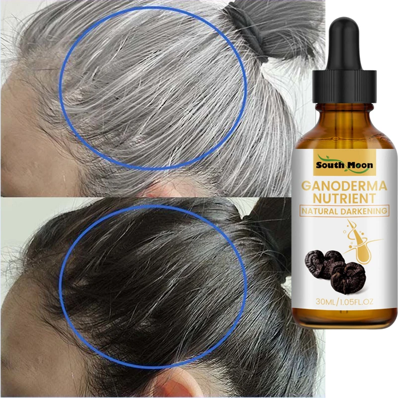 Natural-Anti-Gray-Hair-Serum-Remedy-Treatment-White-Darkening-Liquid ...