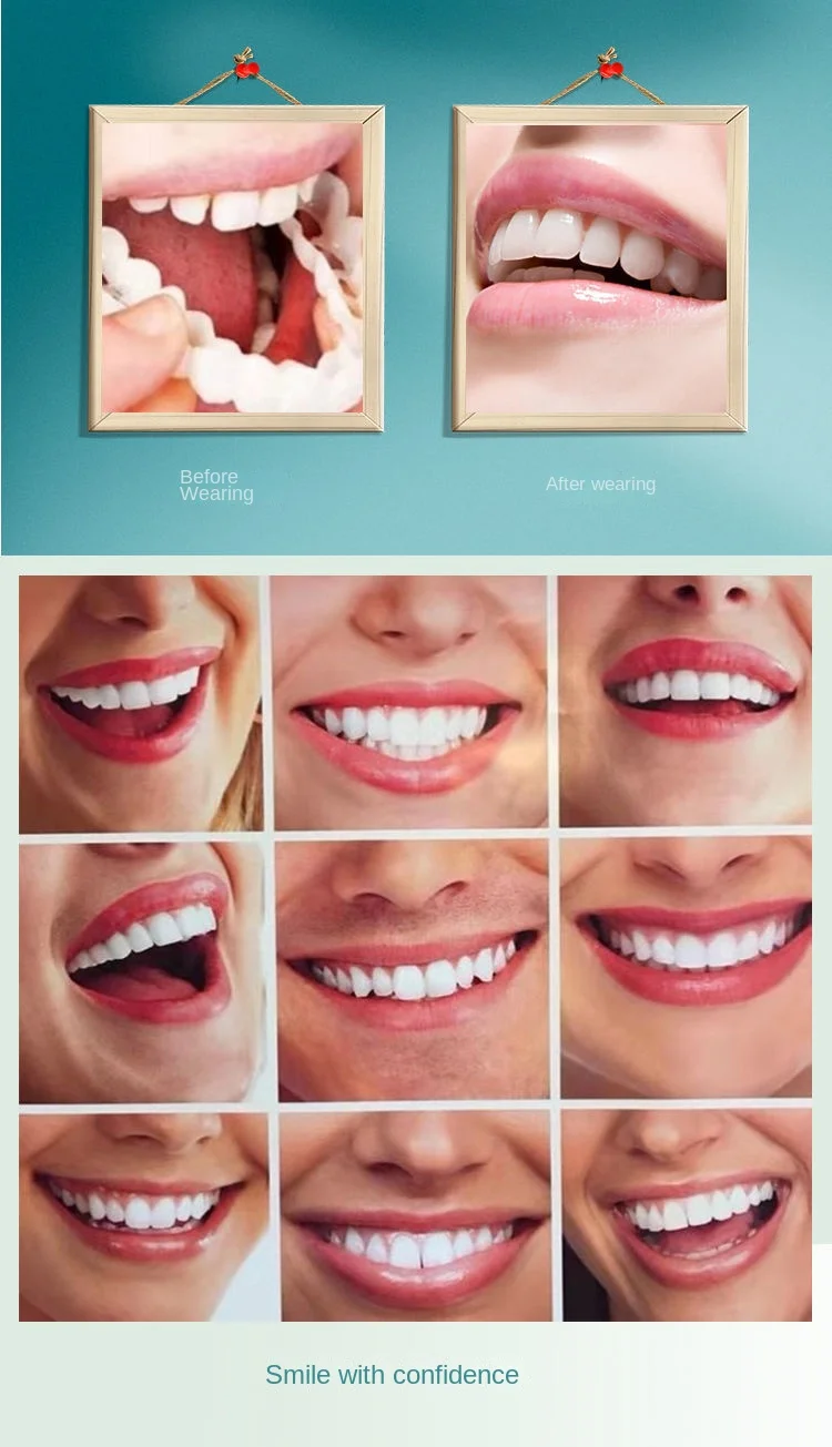 Resin-Teeth-Fake-Teeth-Simulation-Braces-Smiling-Veneers-Dentures ...