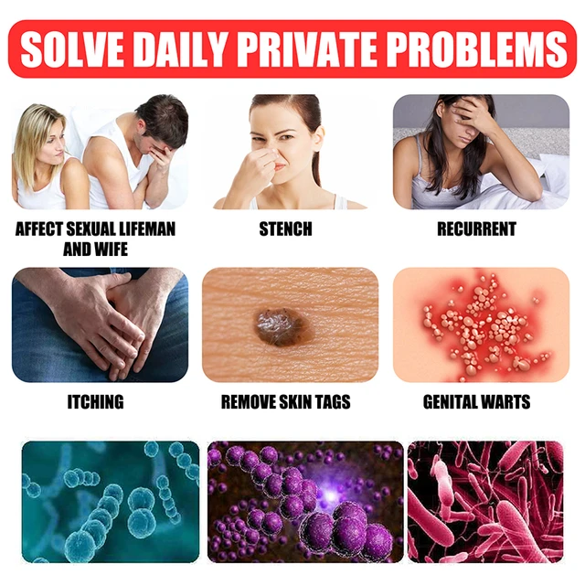 Skin Tags Genital Area