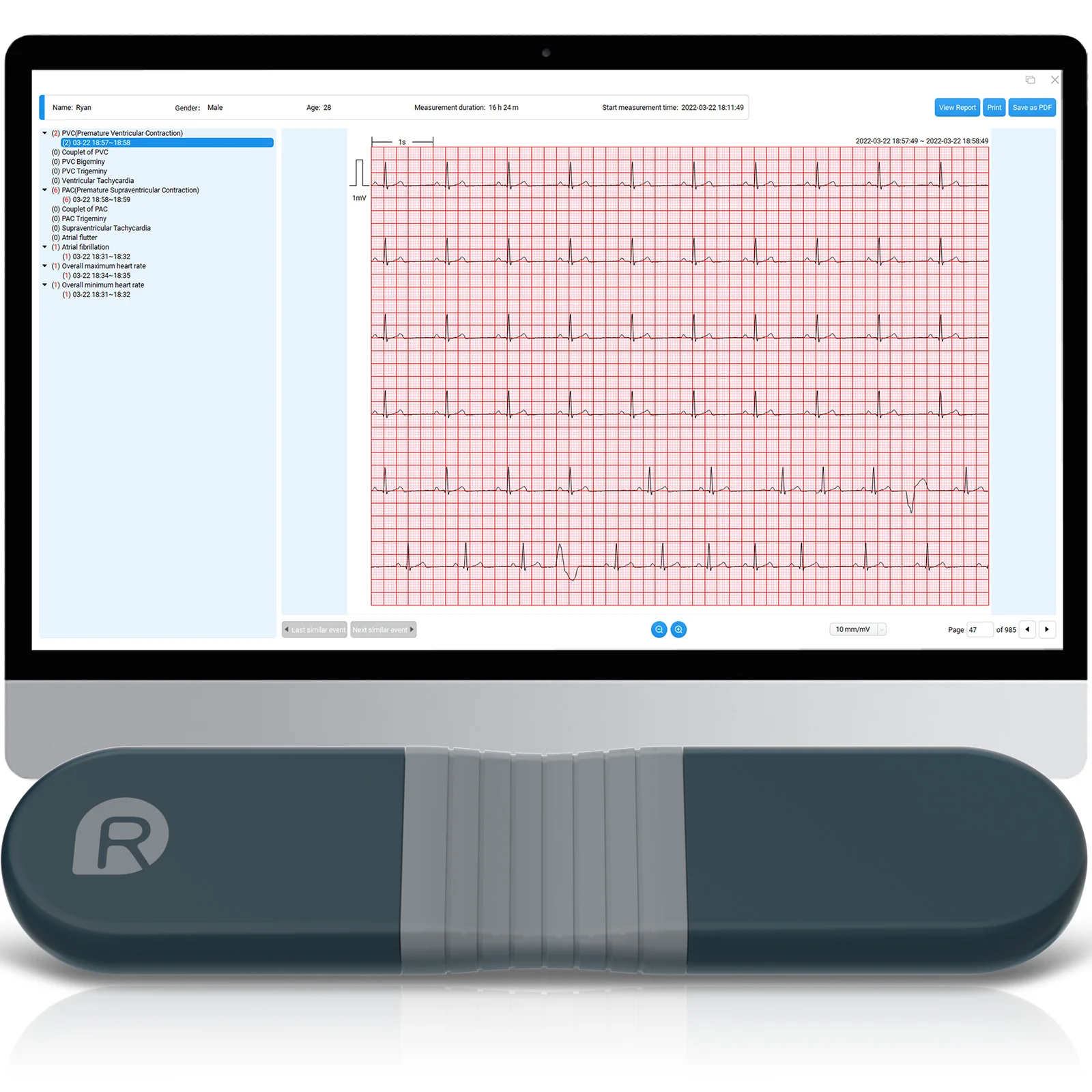Wellue Heart Health Monitor Ecg Recorder at Marcus Dacomb blog