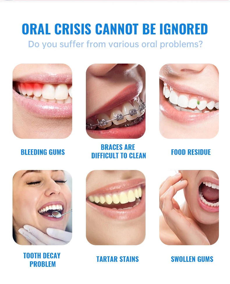 Buse standard Caredite-Hydropulseur professionnel pour les dents ...