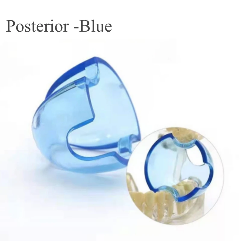 1Pcs Dental Mouth Opener Expander for Anterior Posterior Teeth Plastic ...