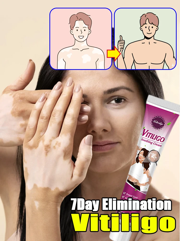 NewVitiligo-Ointment-Effectively-Remove-White-Spot-Removal-Body-Skin ...